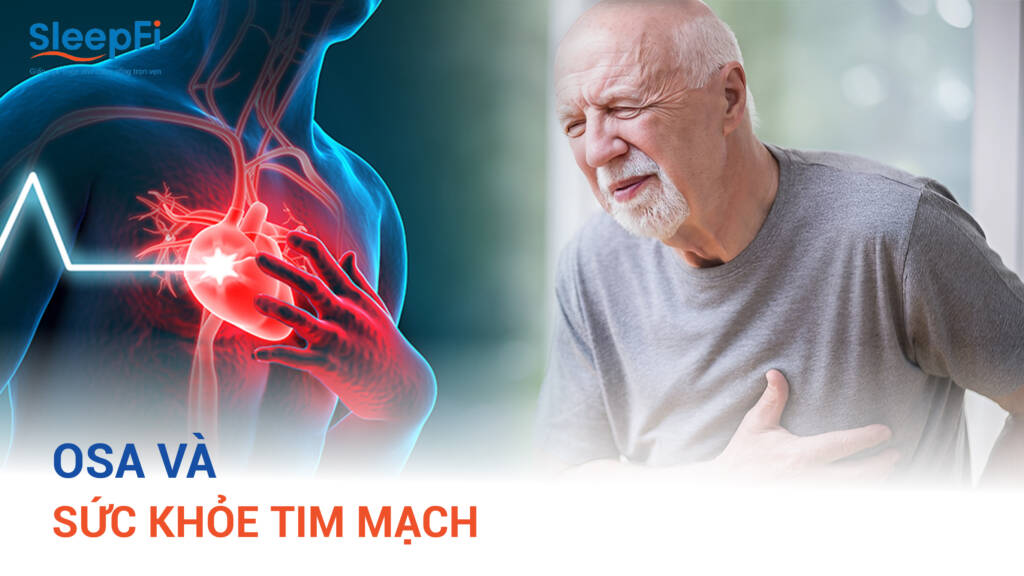 OSA Và Sức Khỏe Tim Mạch ảnh Hưởng đến Nhau Thế Nào? - SleepFi